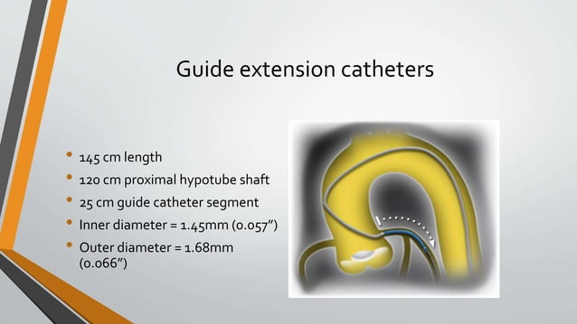 Guide catheters in coronary intervention | PPTX