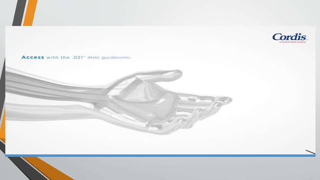 Guide catheters in coronary intervention | PPTX