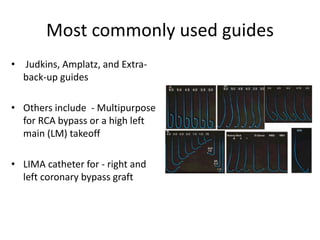 guide catheter during coronary artery disease.ppt