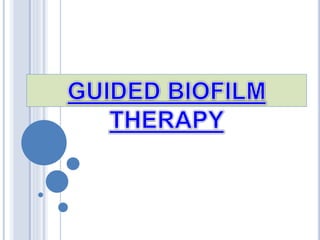 guided biofilm device.pptx periodontology | PPTX