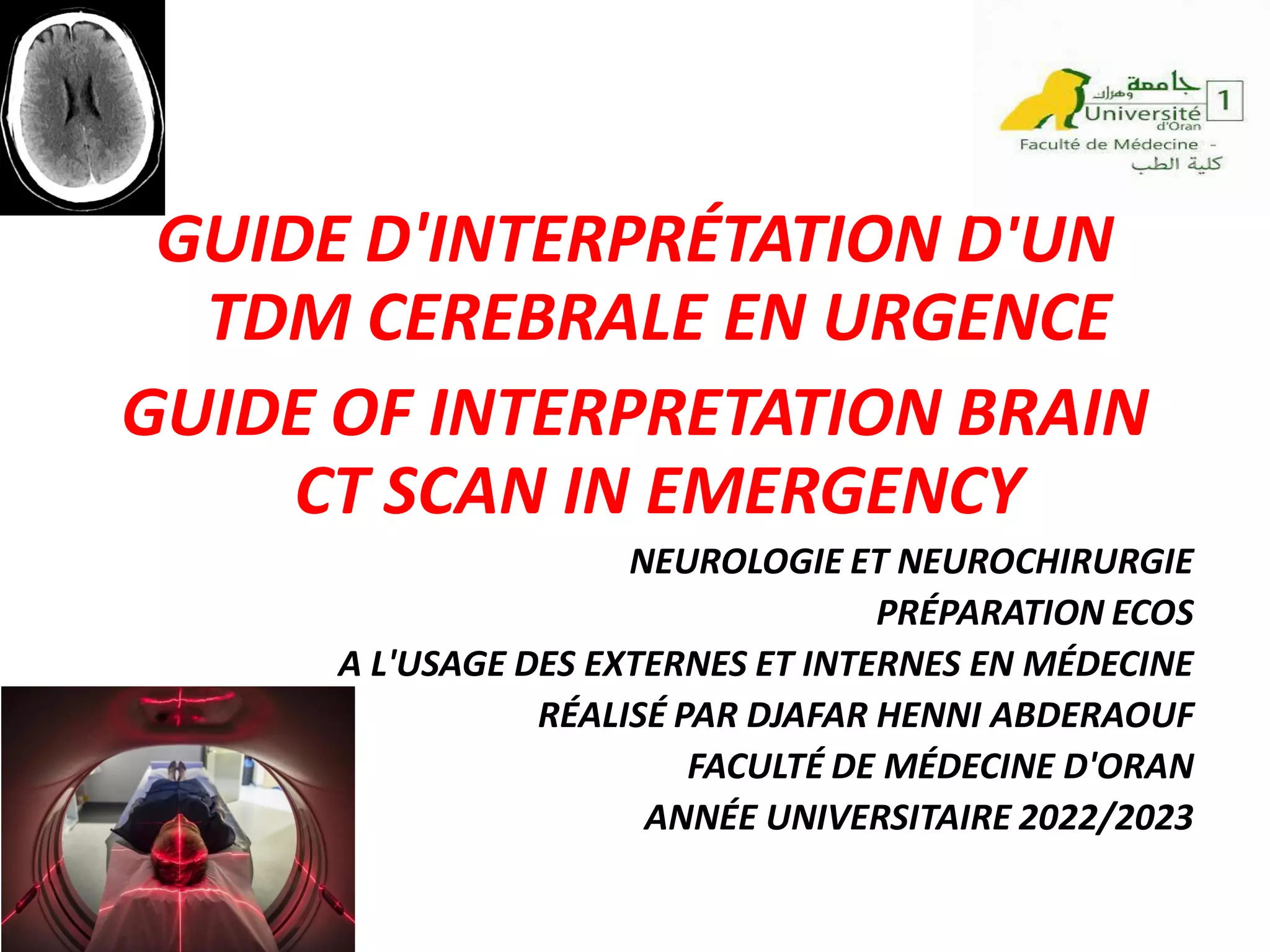GUIDE D'INTERPRETATION D'UN TDM CEREBRALE EN URGENCE.pdf