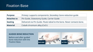 GuidedSMILE NobelBiocare Surgical Components | PPT