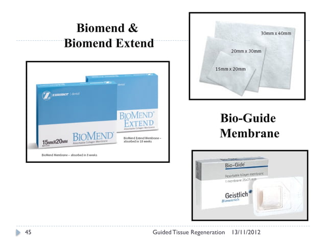 GUIDED TISSUE (BONE) REGENERATION PERIO.pptx