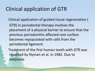 Guided tissue regeneration | PPTX