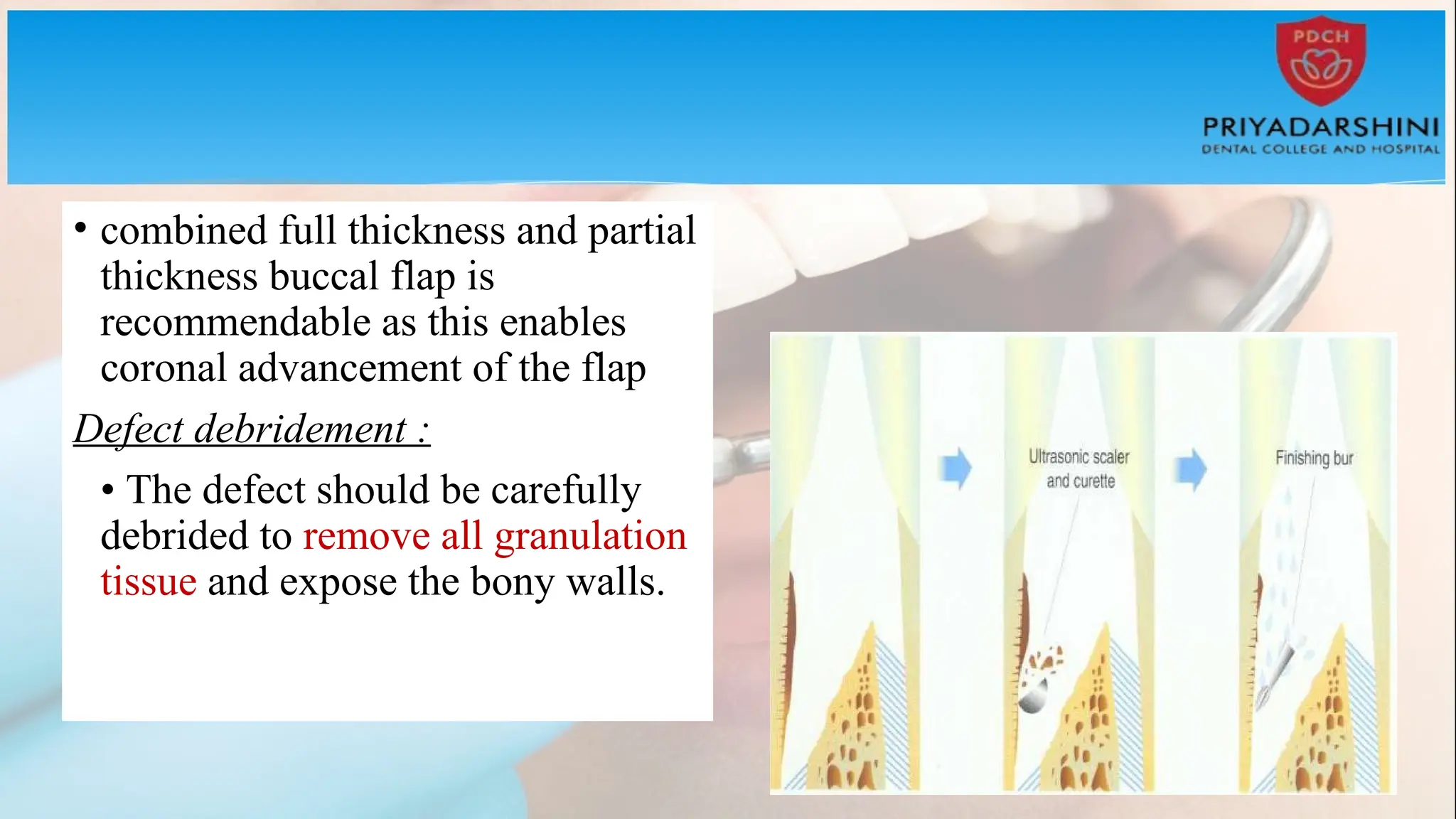 Guided tissue regeneration in perio.pptx