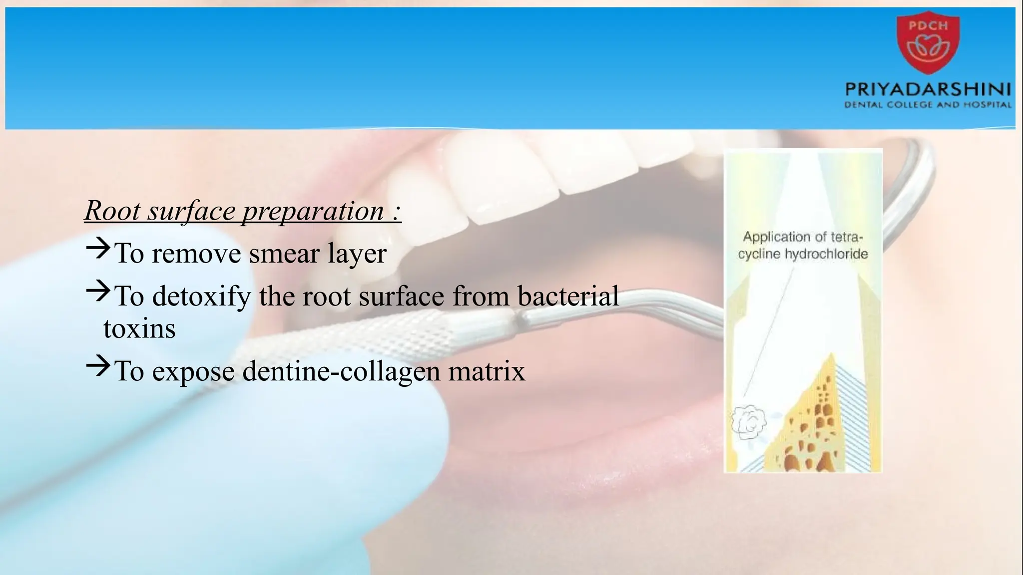 Guided tissue regeneration in perio.pptx