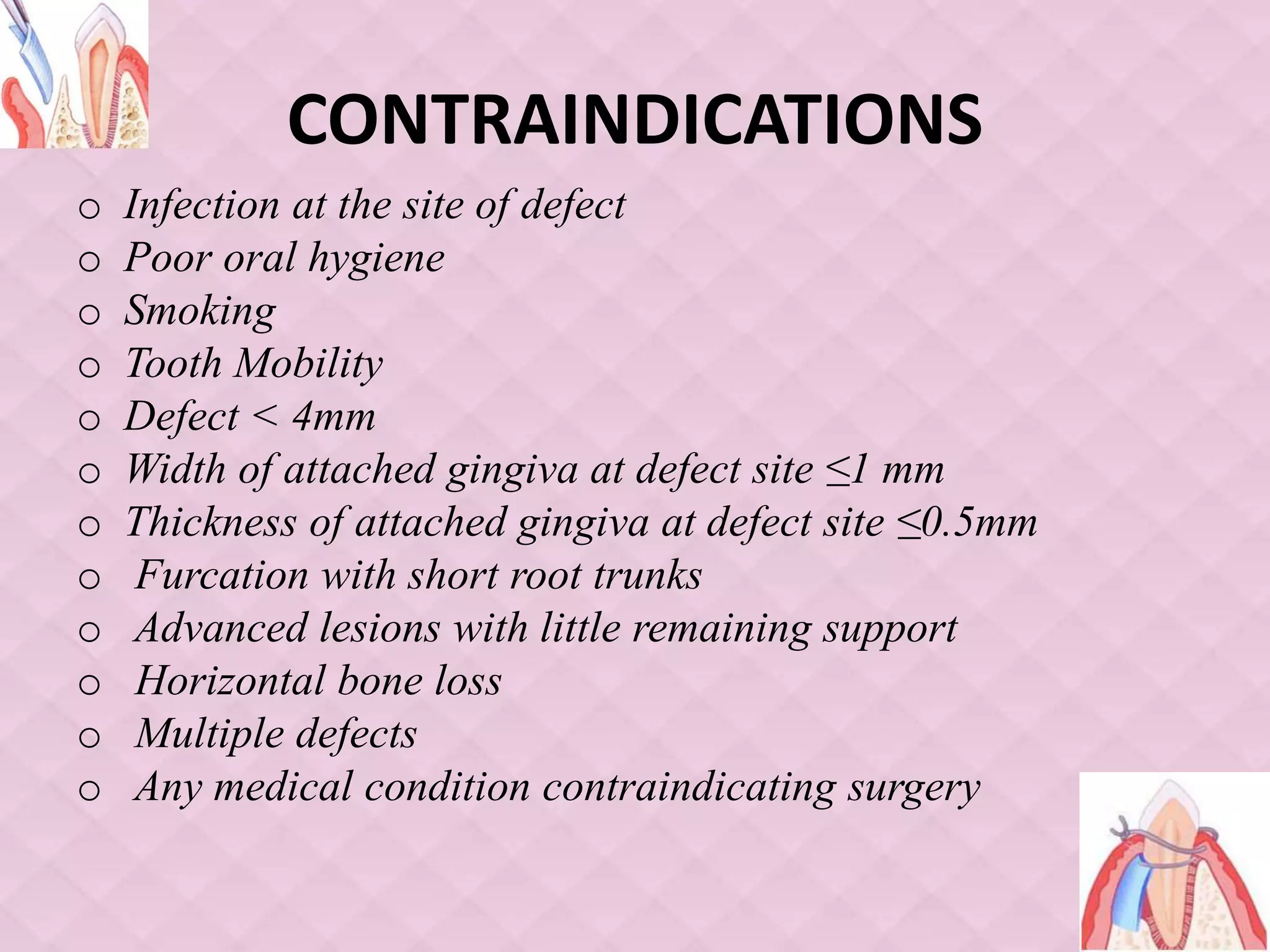 "GUIDED TISSUE REGENERATION" | PPTX