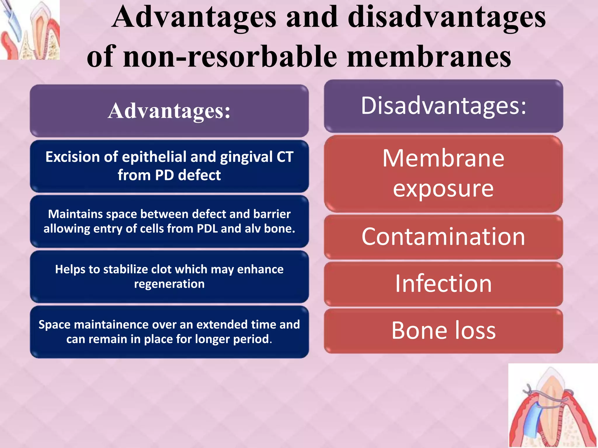 "GUIDED TISSUE REGENERATION" | PPTX