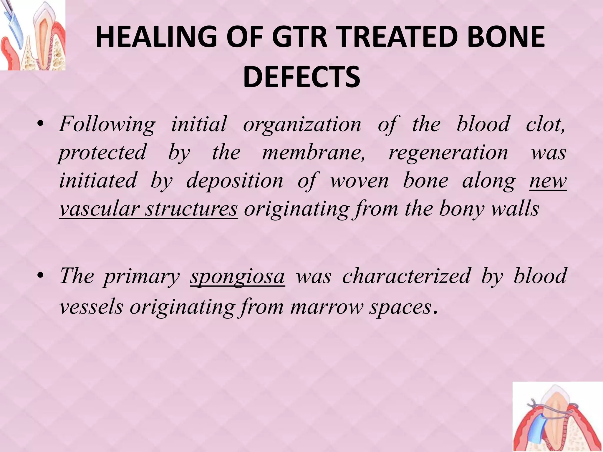 "GUIDED TISSUE REGENERATION" | PPTX