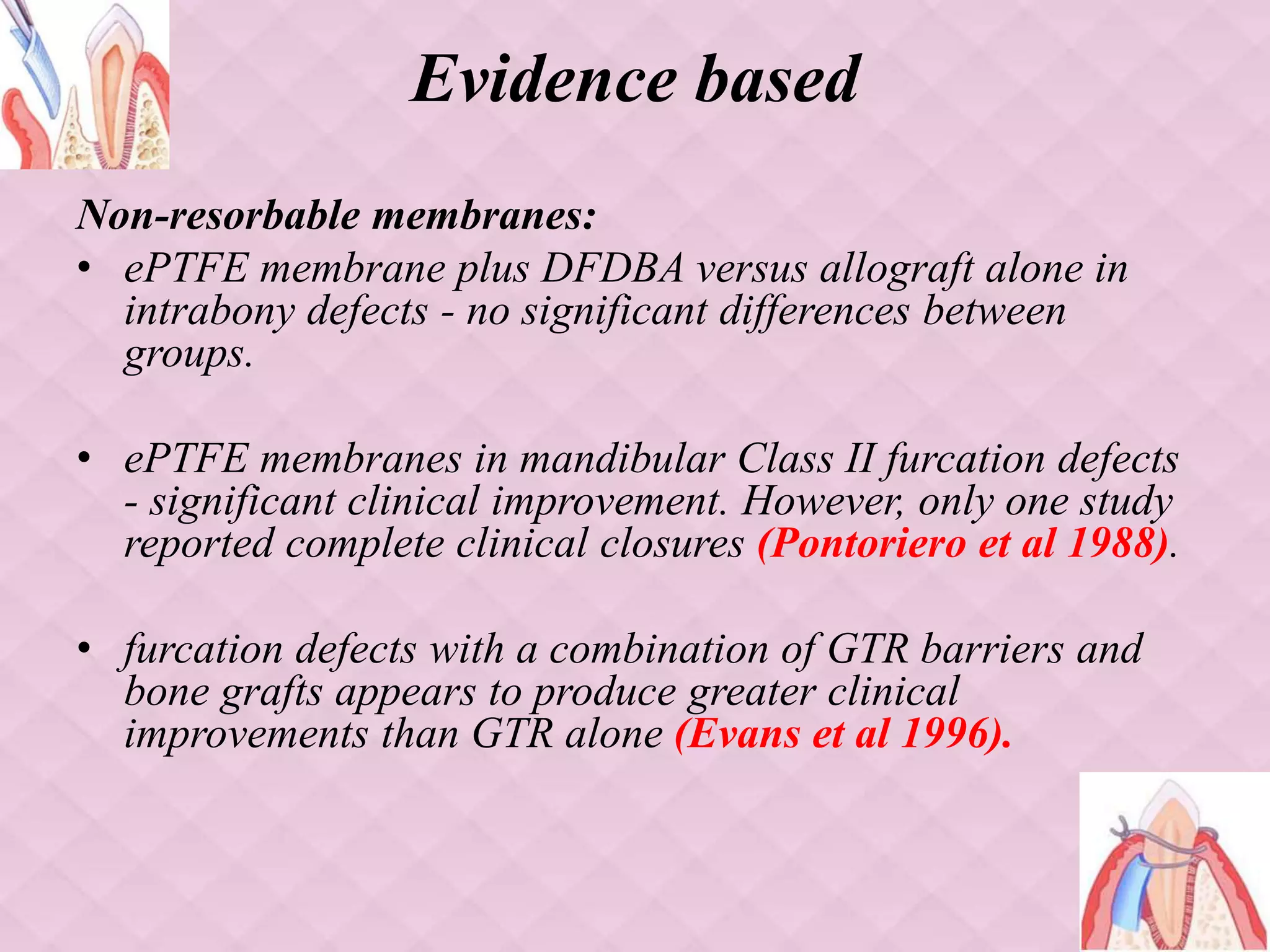 "GUIDED TISSUE REGENERATION" | PPTX