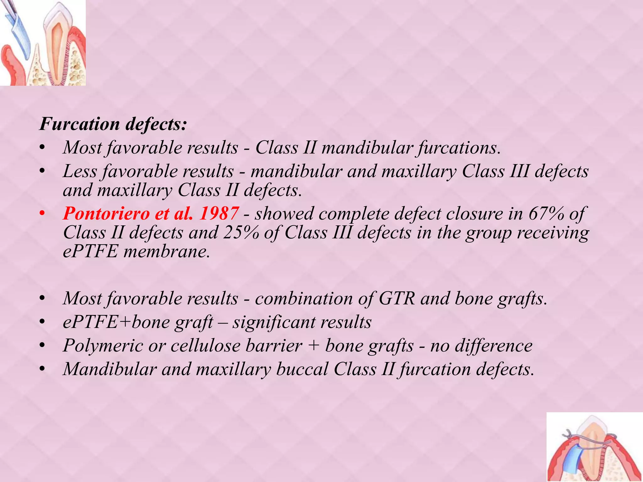 "GUIDED TISSUE REGENERATION" | PPTX