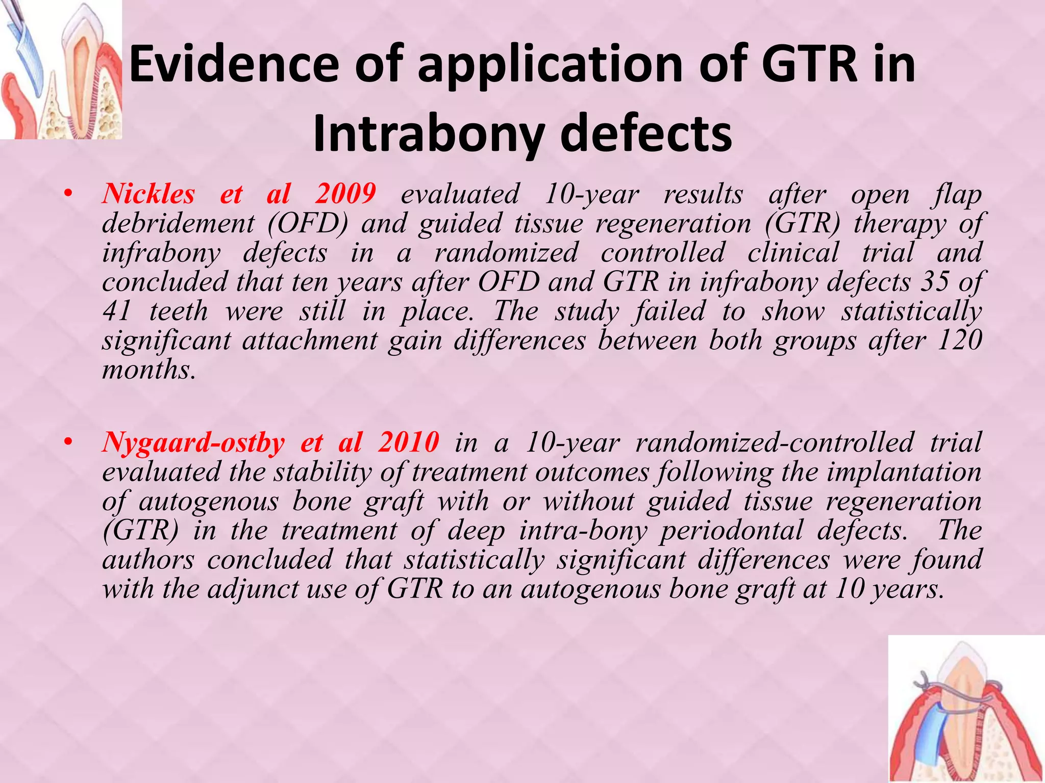 "GUIDED TISSUE REGENERATION" | PPTX