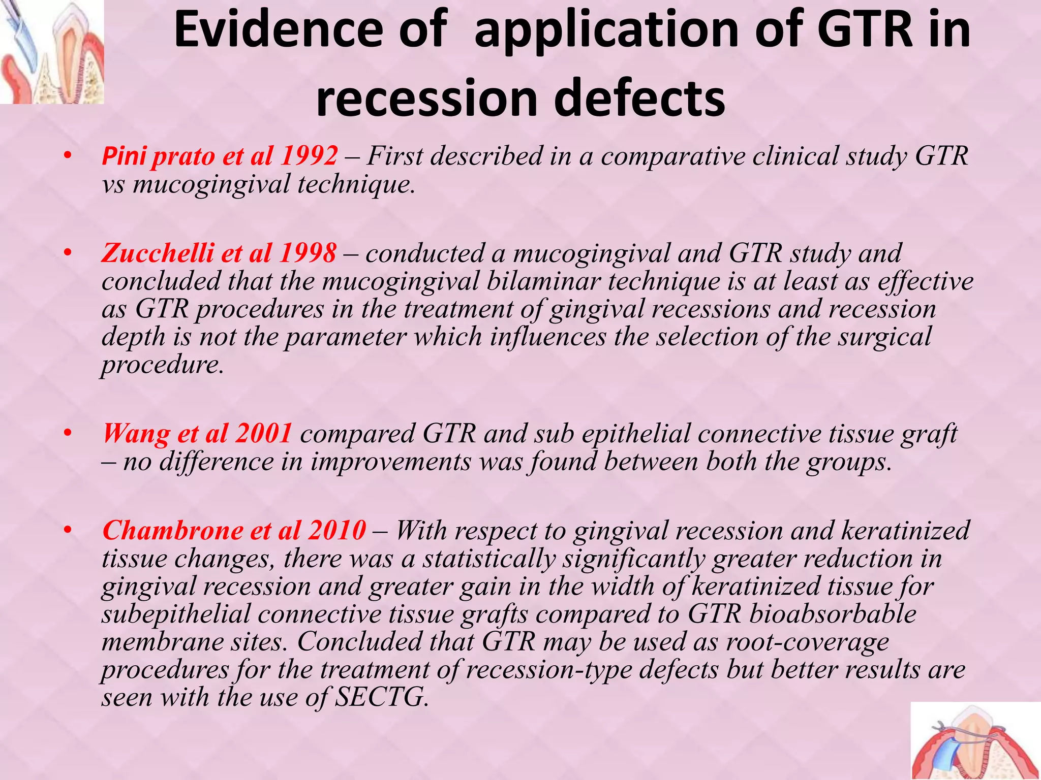 "GUIDED TISSUE REGENERATION" | PPTX