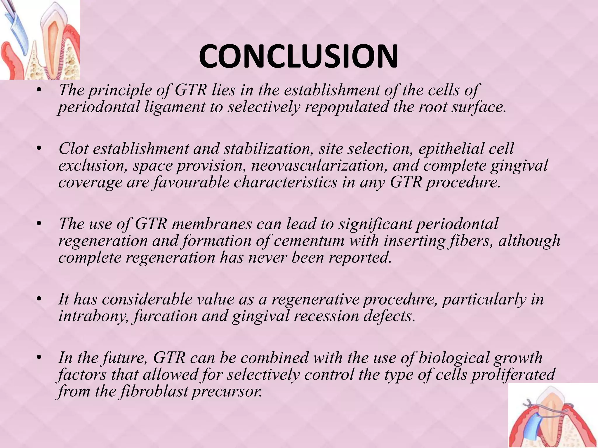 "GUIDED TISSUE REGENERATION" | PPTX