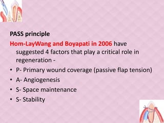 "GUIDED TISSUE REGENERATION" | PPTX