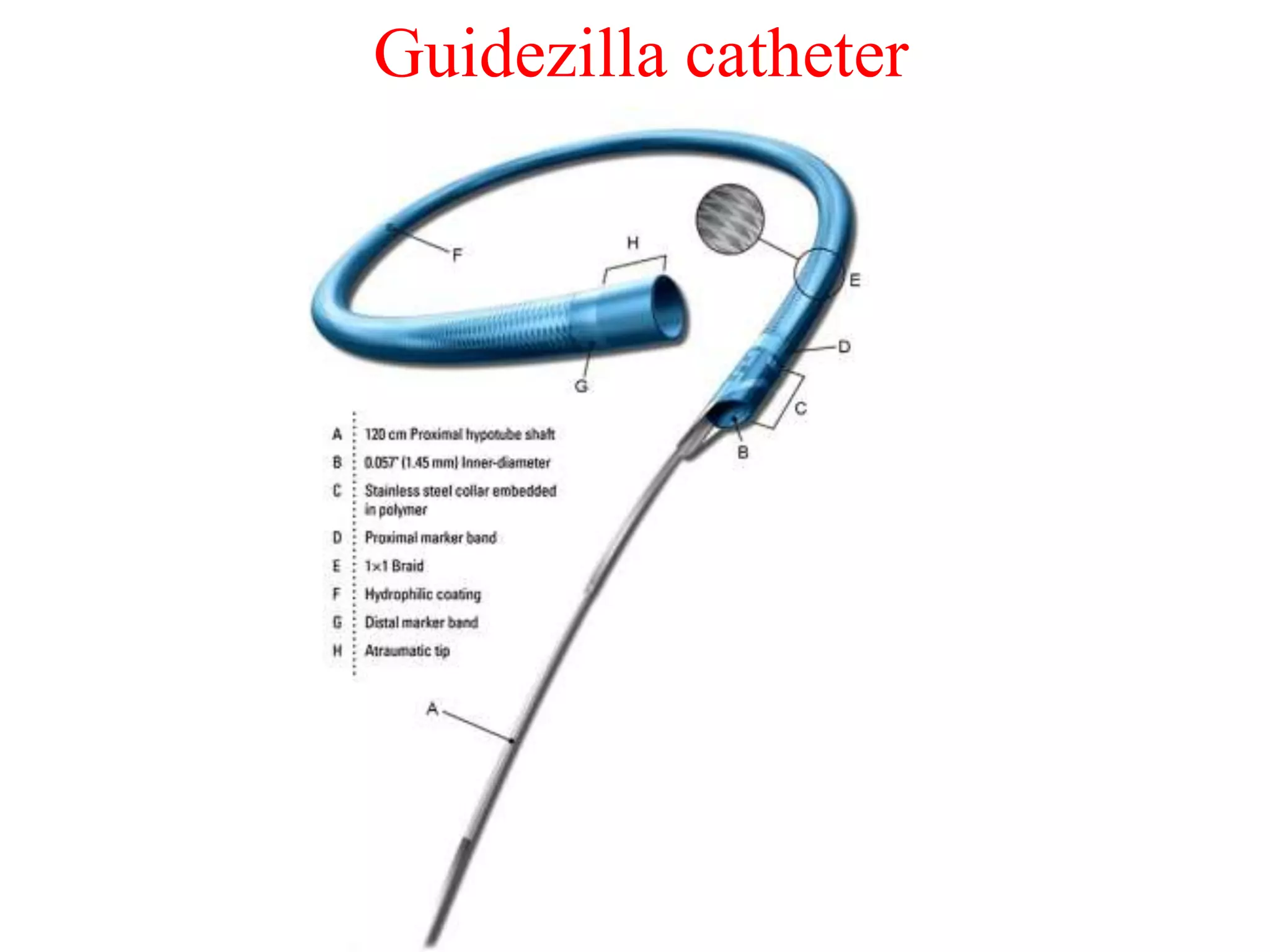 Guide Extension Catheter | PPTX