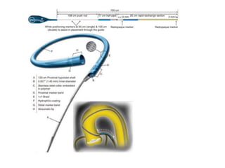 Guide Extension Catheter | PPTX