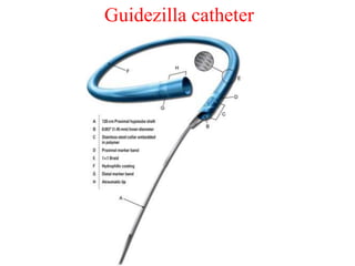 Guide Extension Catheter | PPTX