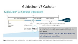 GUIDE EXTENSION CATHETER ...........pptx