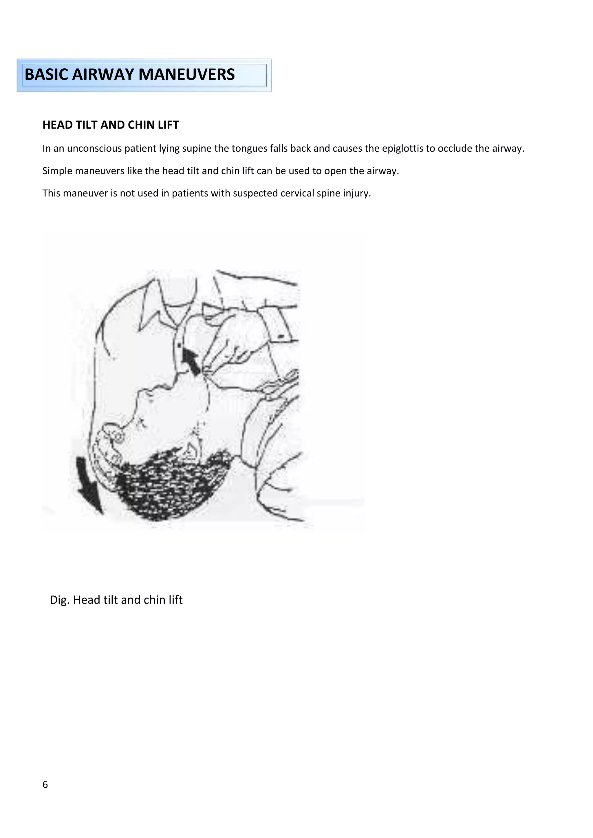 Guideline for airway management3 | PDF