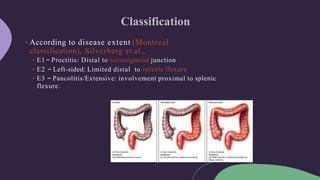 Guideline ppt on Ulcerative colitis | PPTX