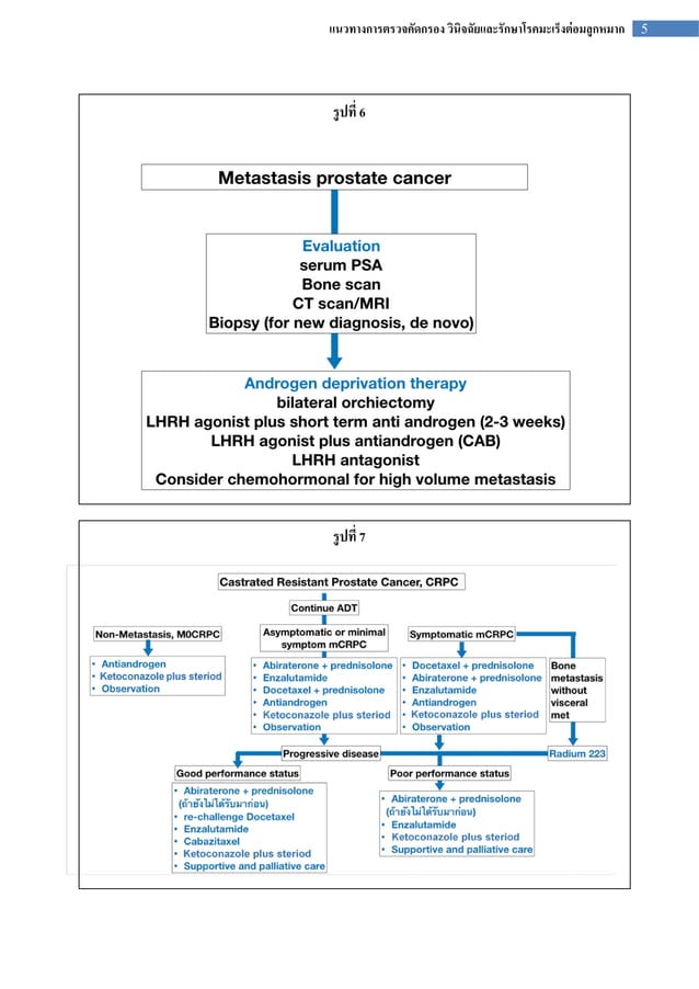Guideline prostate cancer | PDF