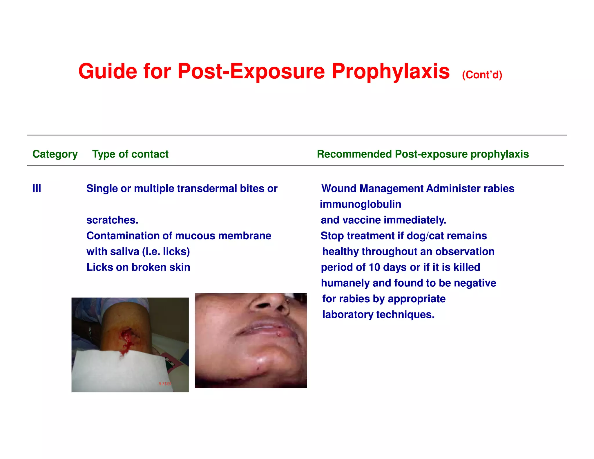 Guideline_Rabies_prophylaxis_PPT_PDF.pdf