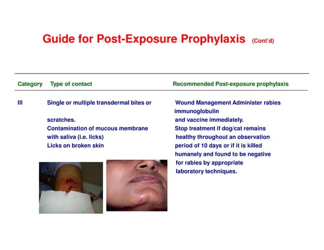 Guideline_Rabies_prophylaxis_PPT_PDF.pdf