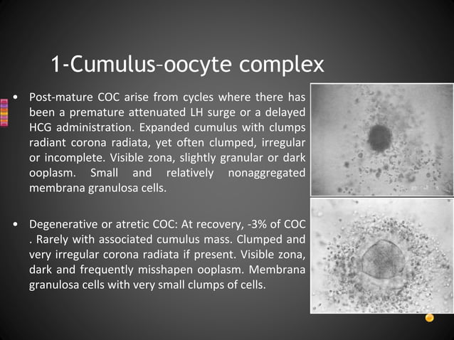 Oocyte Morphology assessment | PPTX | Infertility | Reproductive Health