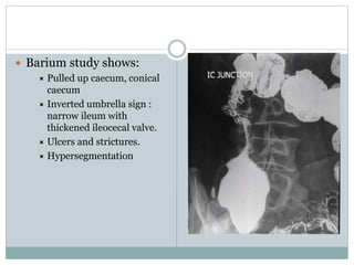 Guidelines for extra pulmonary TB in India | PPT