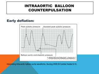 Guidelines for intraaortic balloon counterpulsation | PPT