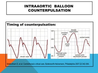 Guidelines for intraaortic balloon counterpulsation | PPT