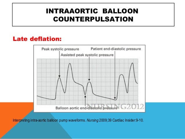 Guidelines for intraaortic balloon counterpulsation