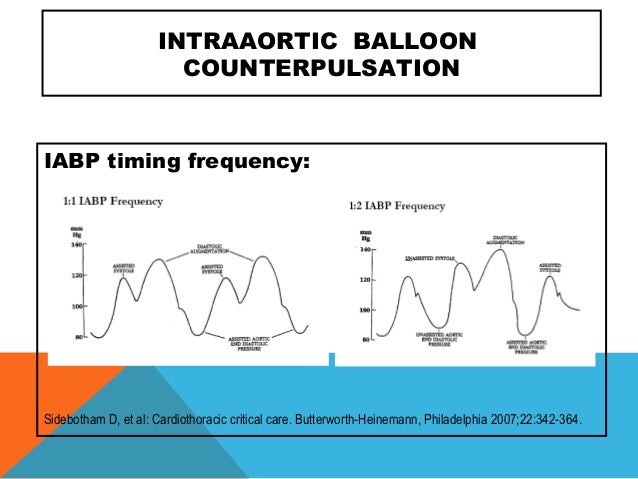 Guidelines for intraaortic balloon counterpulsation
