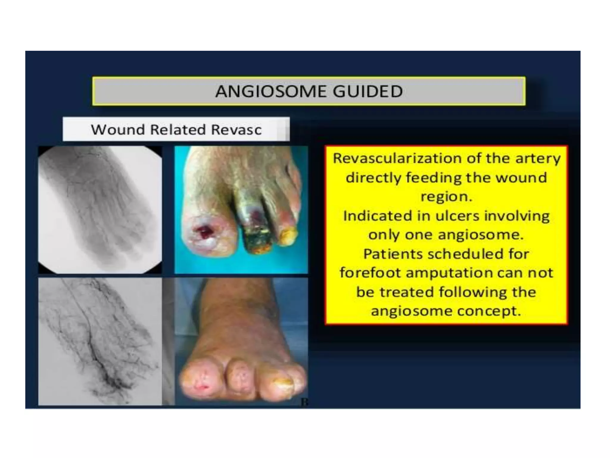 Guidelines For Management Of Peripheral Arterial Disease Ppt