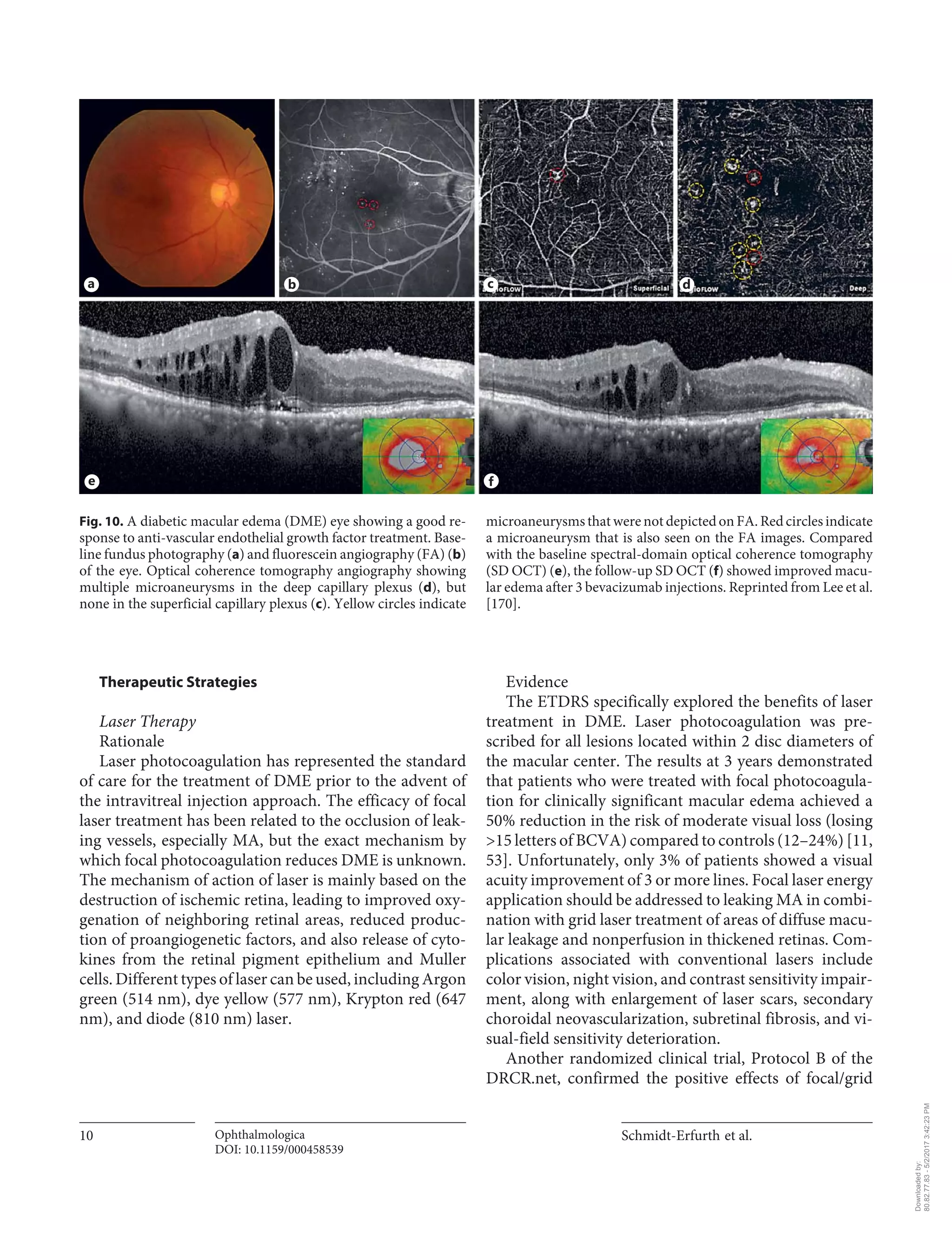 Guidelines for the Management of Diabetic Macular Edema.pdf