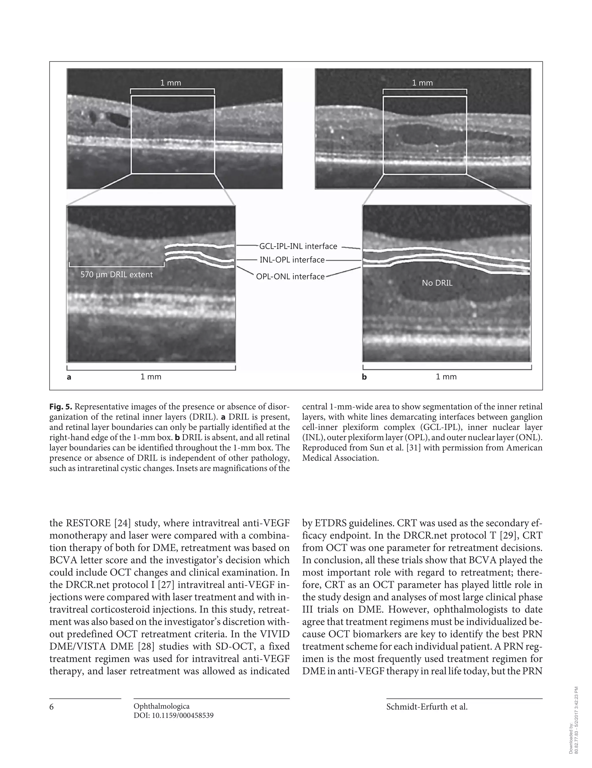 Guidelines for the Management of Diabetic Macular Edema.pdf