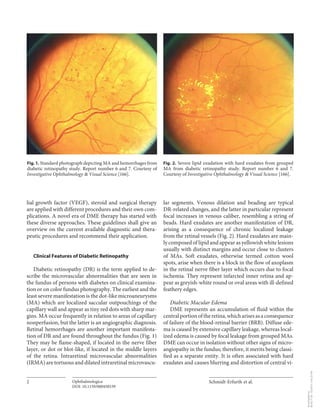Guidelines for the Management of Diabetic Macular Edema.pdf