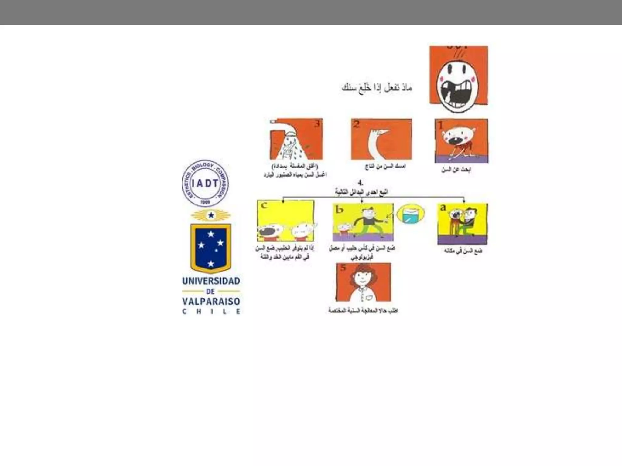 Guidelines for the management of avulsion | PPTX