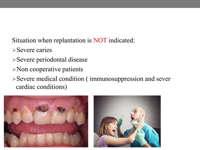 Guidelines for the management of avulsion | PPTX | Dental Health ...