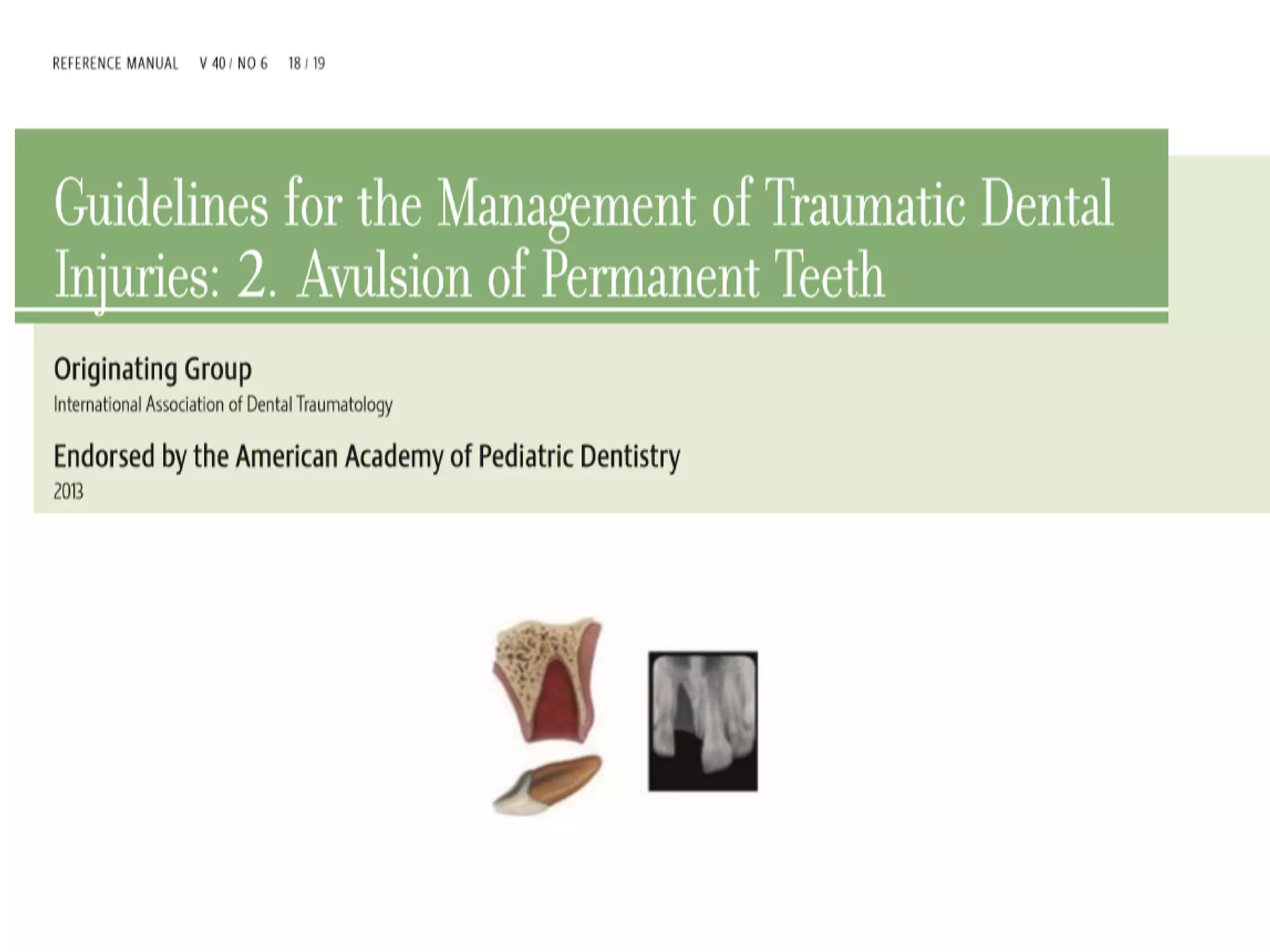 Guidelines for the management of traumatic dental injuries.ii.avulsion ...