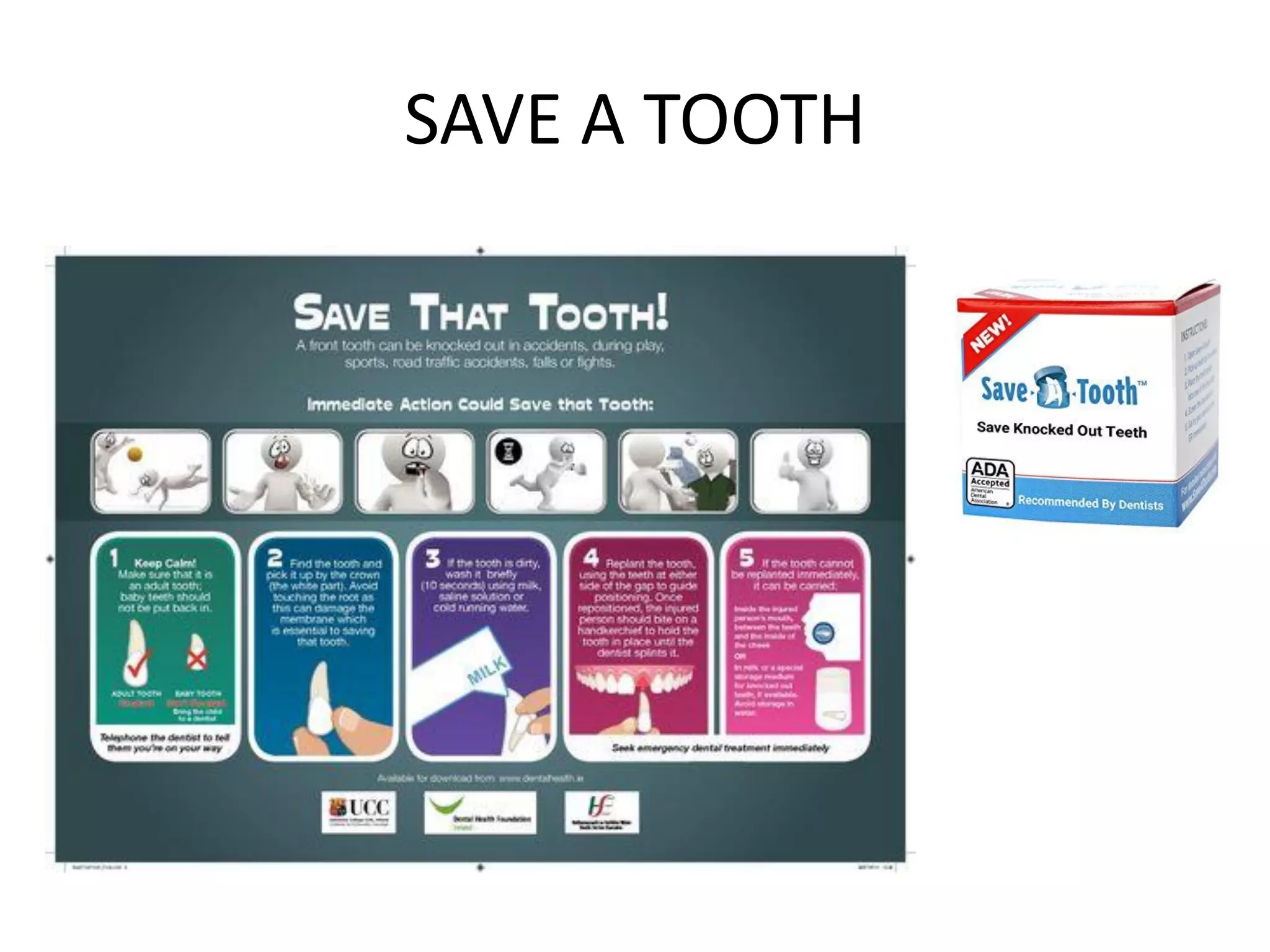 Guidelines for the management of traumatic dental injuries.ii.avulsion ...