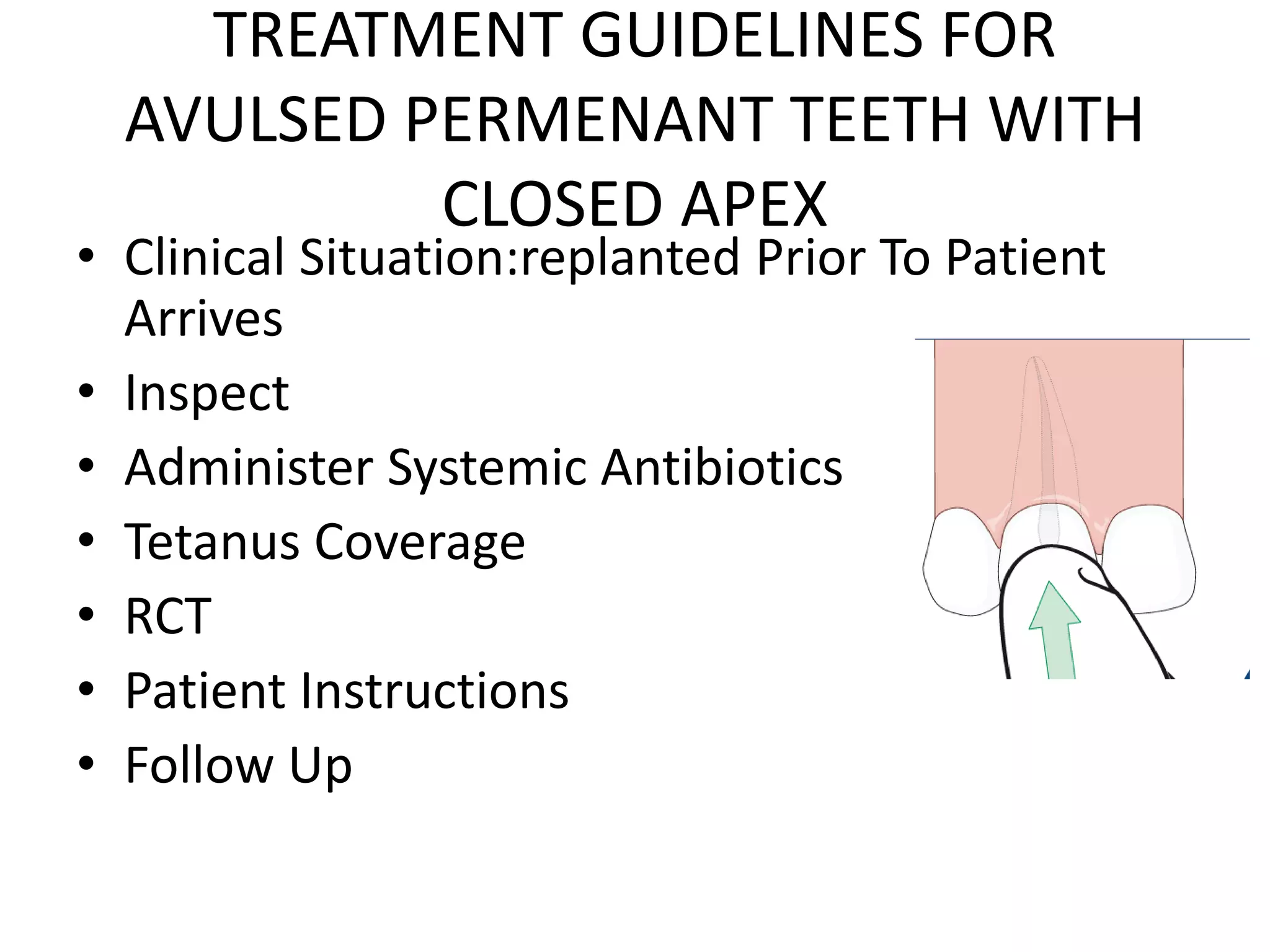 Guidelines for the management of traumatic dental injuries.ii.avulsion ...