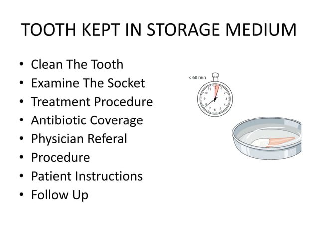 Guidelines for the management of traumatic dental injuries.ii.avulsion ...