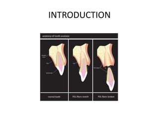 Guidelines for the management of traumatic dental injuries.ii.avulsion ...
