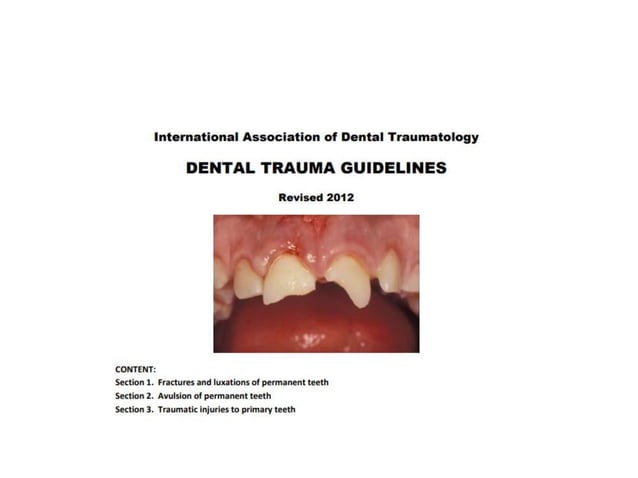 Guidelines for the management of traumatic dental injuries.ii.avulsion ...