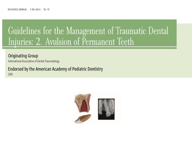 Guidelines for the management of traumatic dental injuries.ii.avulsion ...