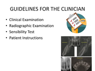 Guidelines for the management of traumatic dental injuries.ii.avulsion ...