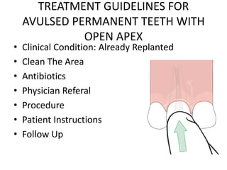 Guidelines for the management of traumatic dental injuries.ii.avulsion ...