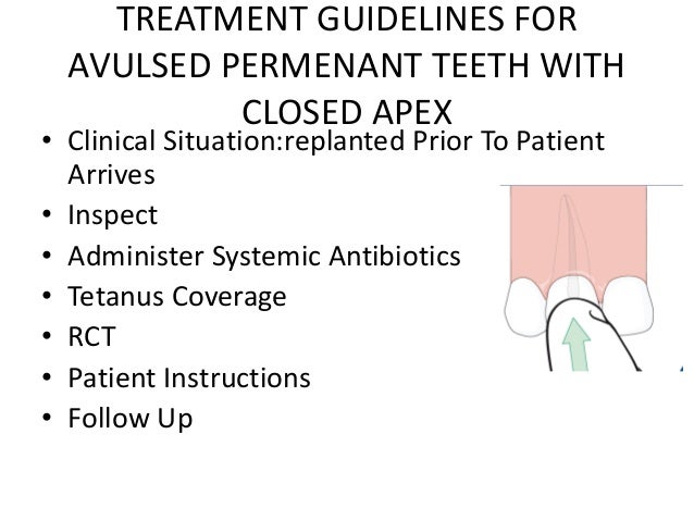 Guidelines for the management of traumatic dental injuries.ii.avulsio…